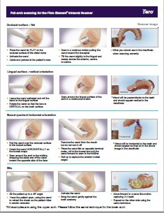 Intra-Oral Scan Information | Oral Arts Dental Laboratories | Oral Arts ...